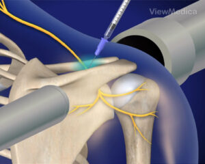 Treatments | Dayton Outpatient Center